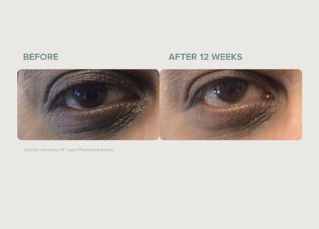 Night Shift Retinol Eye Cream | Hi, Finch